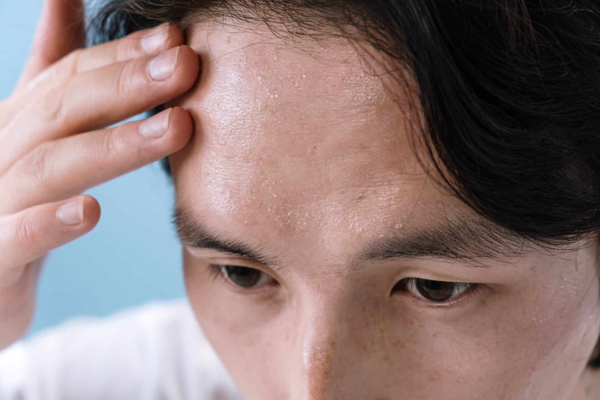De symptomen van een hiv-infectie – Gezondheid staat voorop